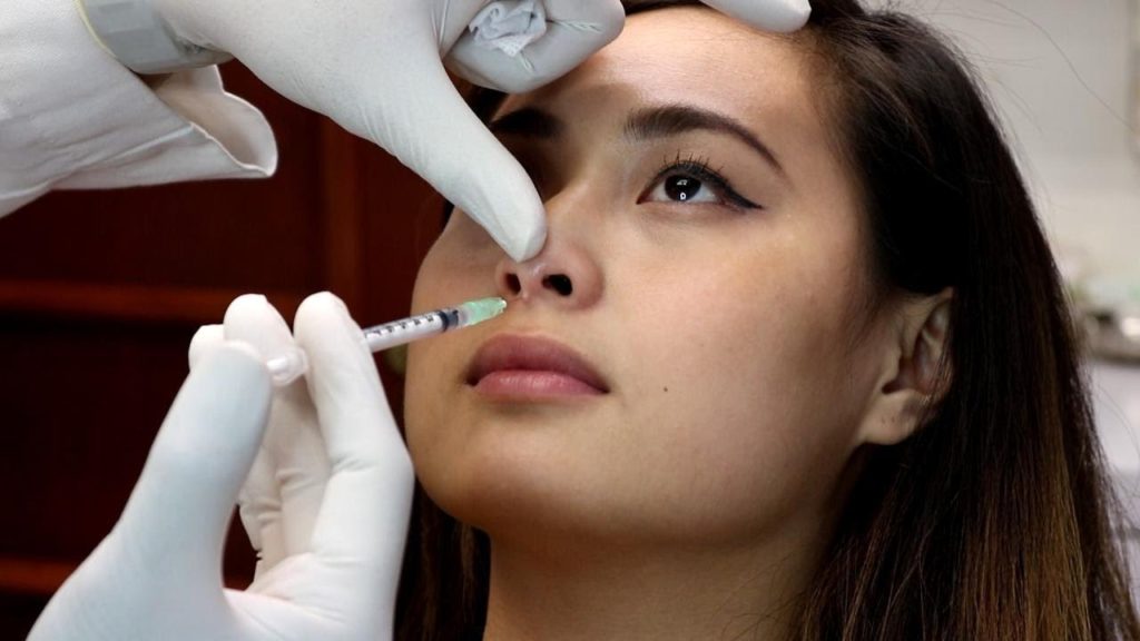 Guide to Getting Nose Thread Lift Procedure in Singapore - Live Enhanced