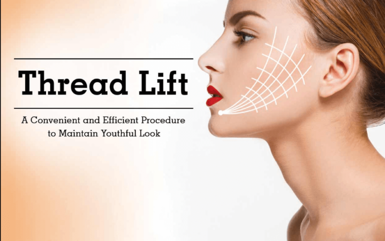 Explanation Advantages and disadvantages of Tread Lift - Live Enhanced