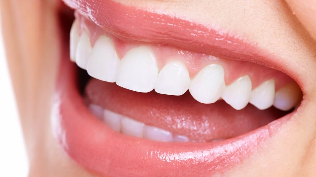 Can I Straighten Teeth Without Braces? All About the Options