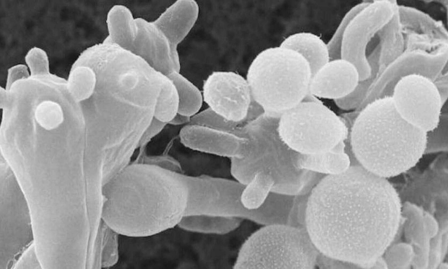 Black Fungus Vs White Fungus : Symptoms & Treatment - Live Enhanced