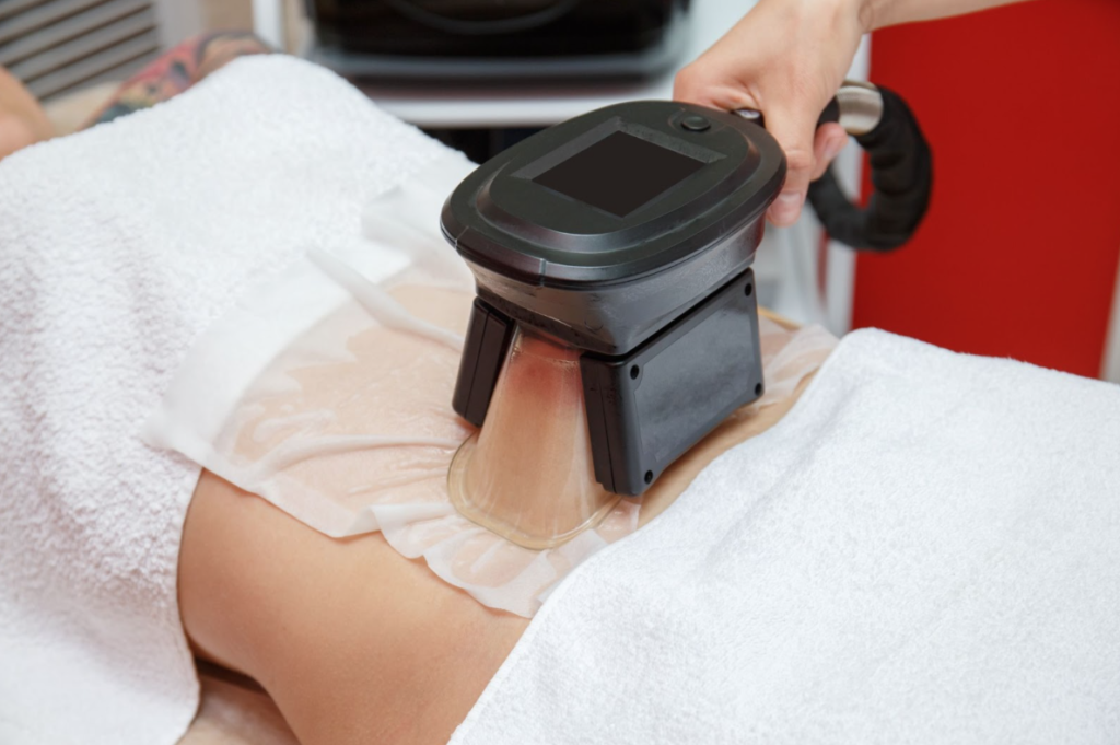 Beyond Fat Removal: Exploring the Transformative Impact of Liposuction ...
